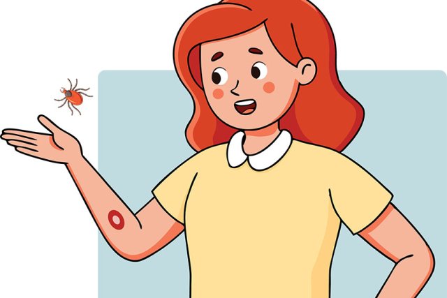 How to Safely Remove a Tick: A Step-by-Step Guide - Academic Kids
